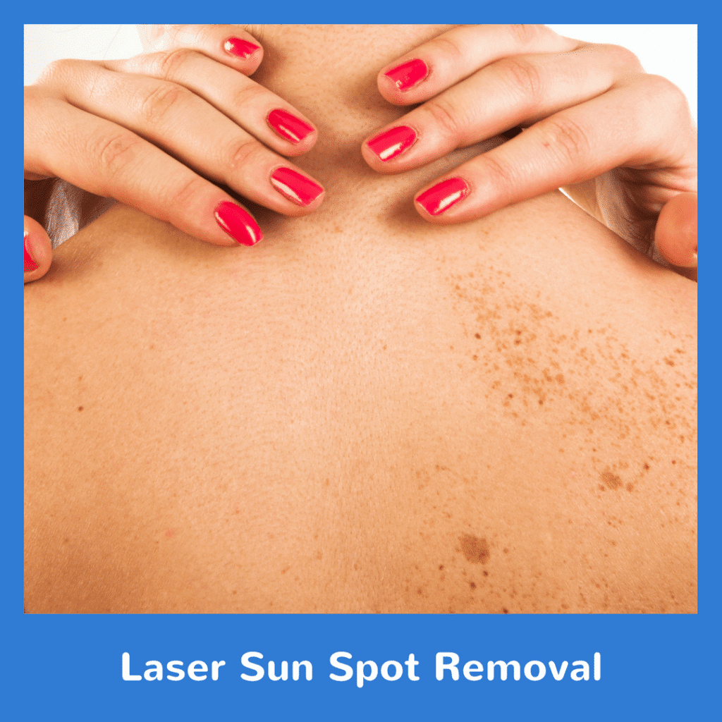 Shop For Services - Shop For Services From Indy Laser